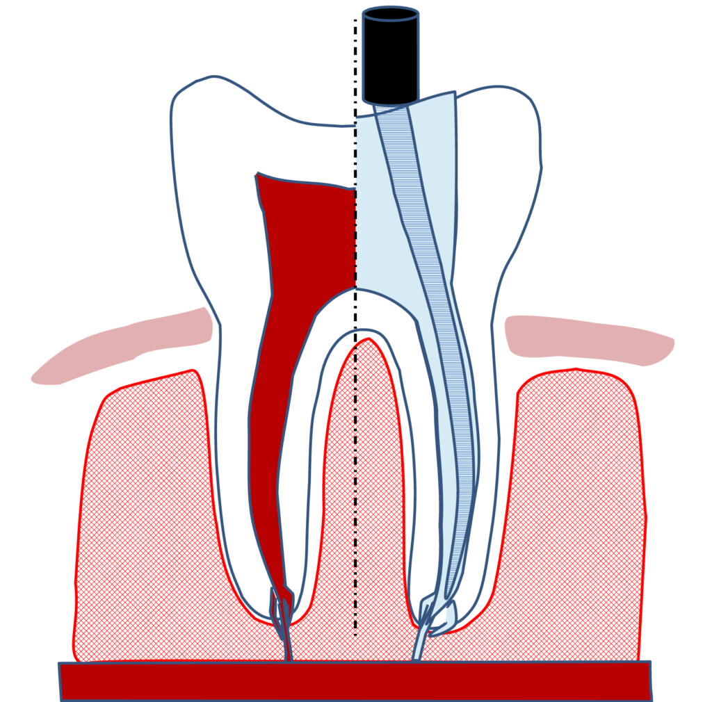 Endodontologie – Gemeinschaftspraxis Börner, Hagen